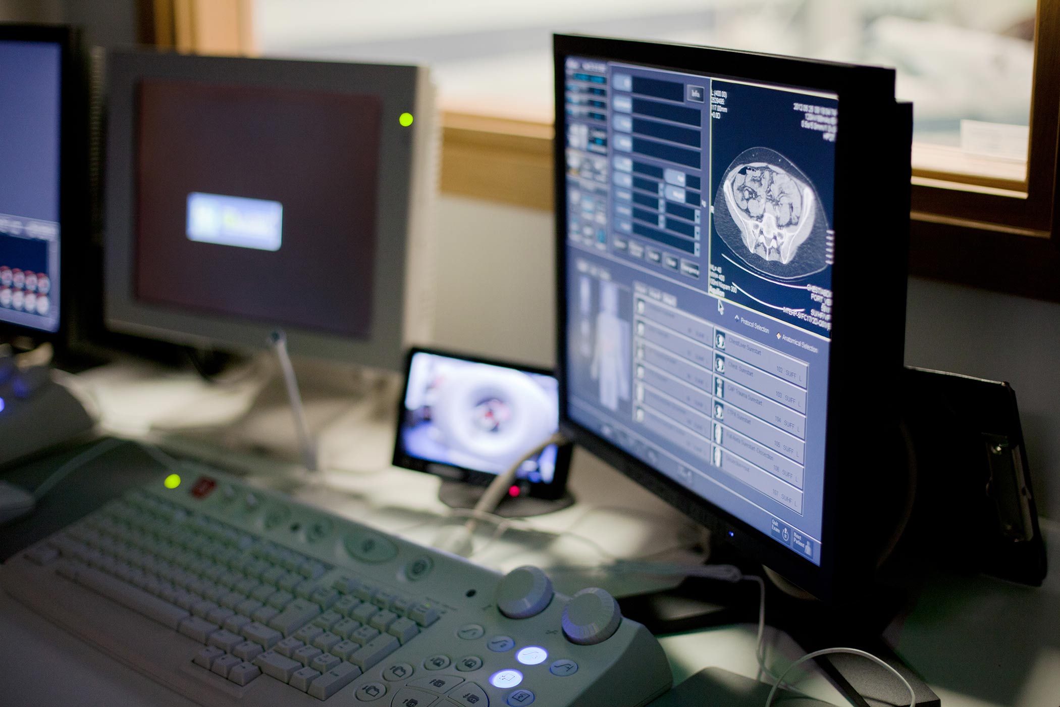 From detection to diagnosis, the opportunities for AI in healthcare